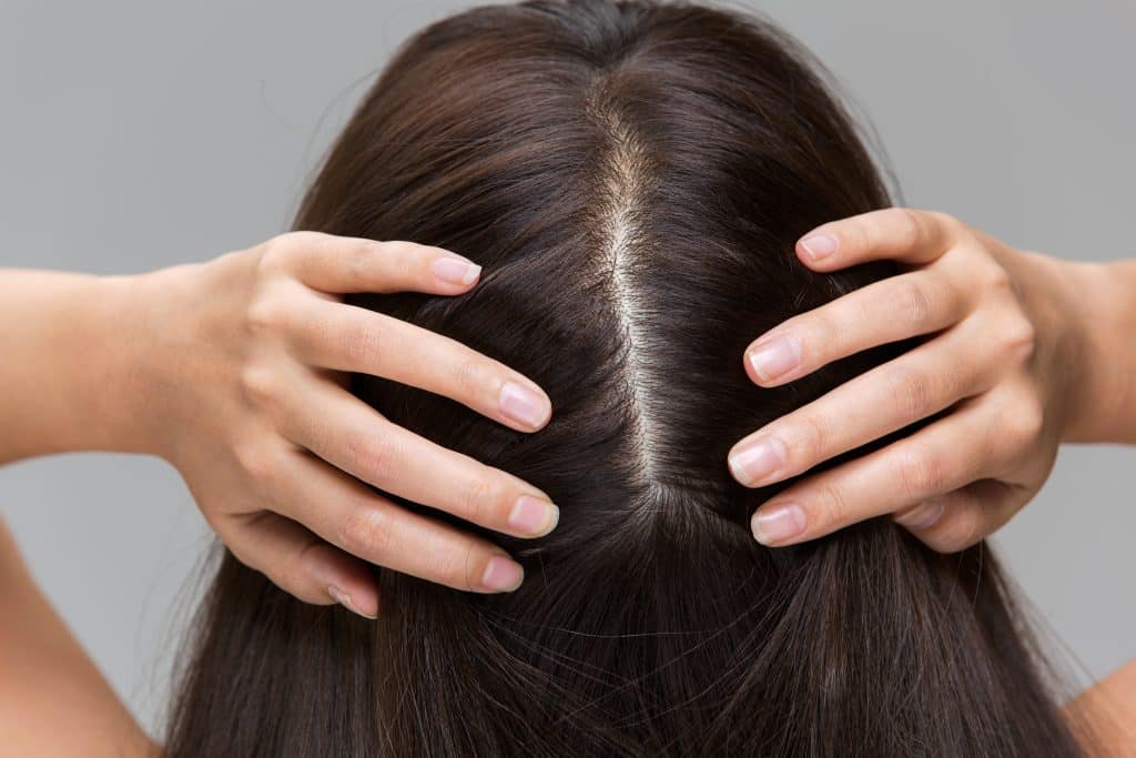 6 Common Types of Scalp Problems and How To Treat Them – PHS HAIRSCIENCE